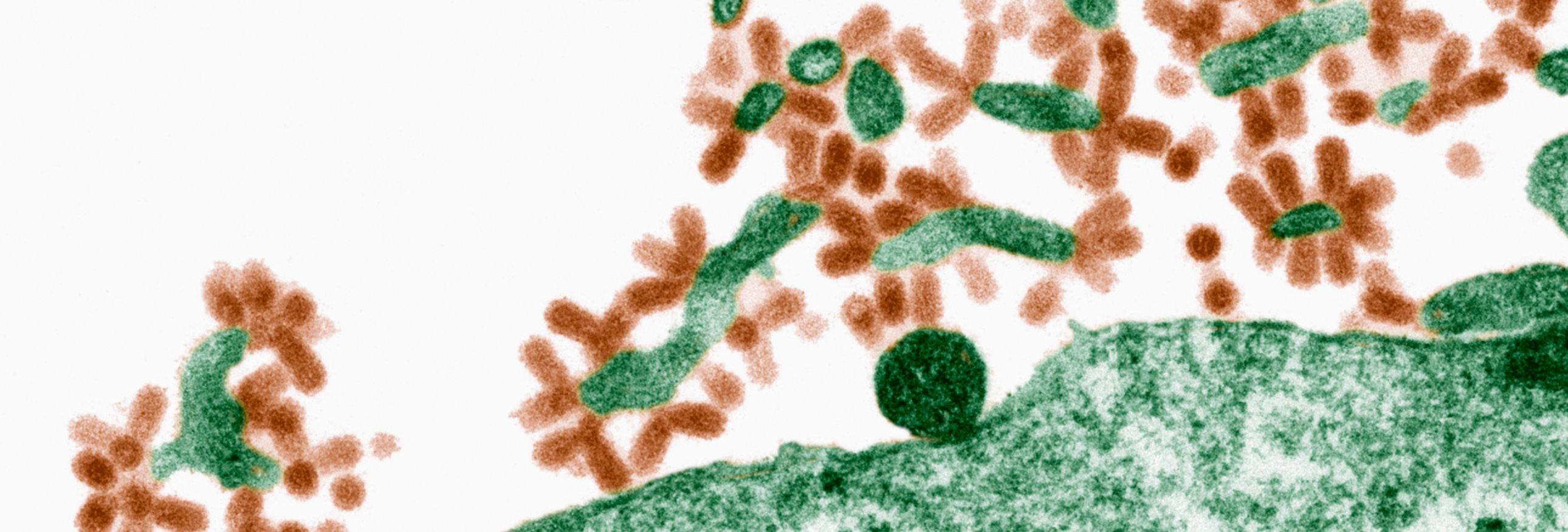Pandemic Planning | The Pew Charitable Trusts