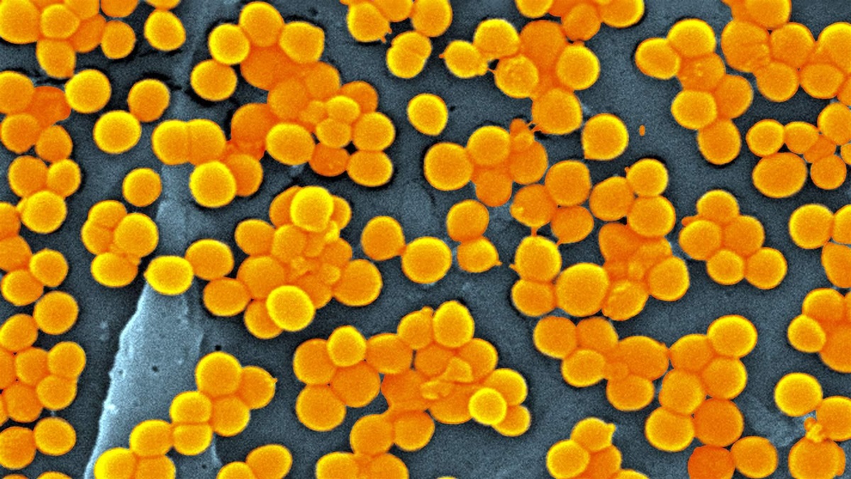 International Efforts Critical to Global Fight Against Superbugs | The ...