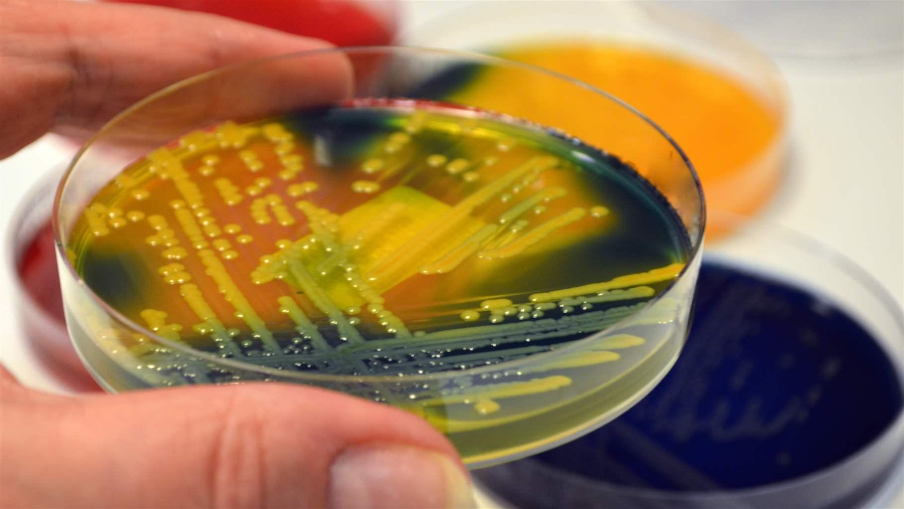 The Shared Platform for Antibiotic Research and Knowledge (SPARK) | The ...