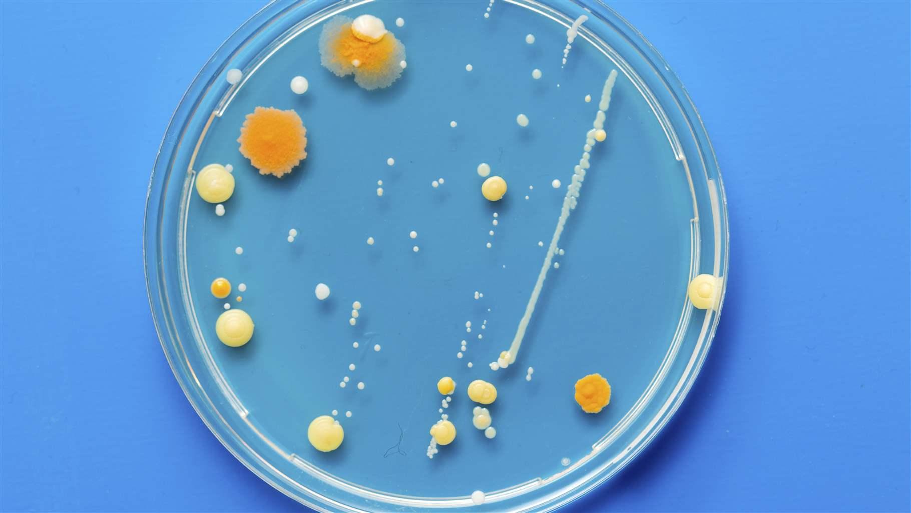 Can You Identify These ‘Invisible’ Microorganisms? | The Pew Charitable ...