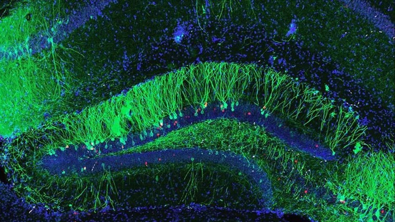 Pew Scholar Investigates How Good and Bad Memories Impact Brain Health ...