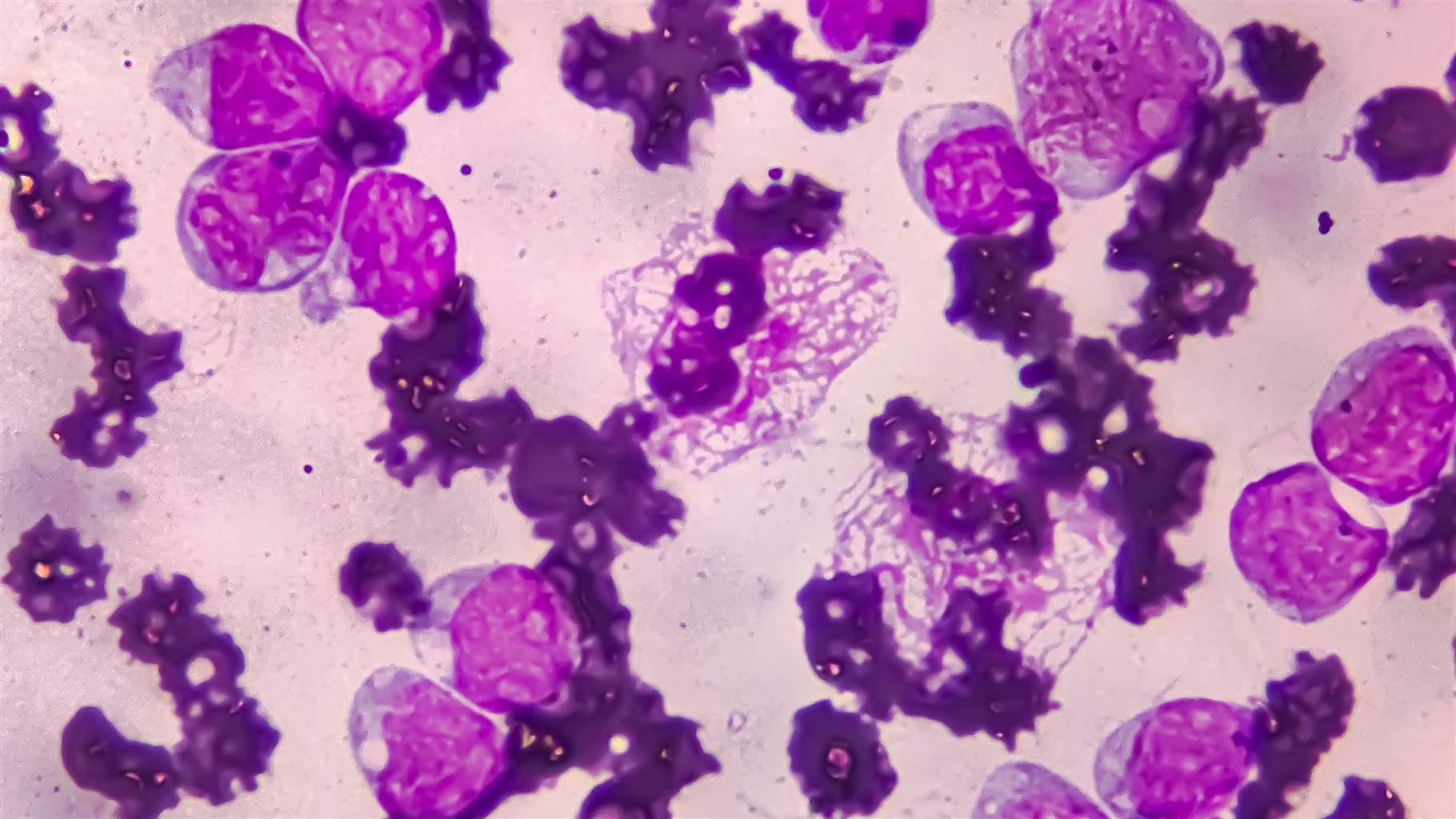 Pew-Stewart Scholar Works to Stop Blood Cancer Before It Develops | The ...